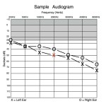 Audiology - Dr. Sean Tubbs